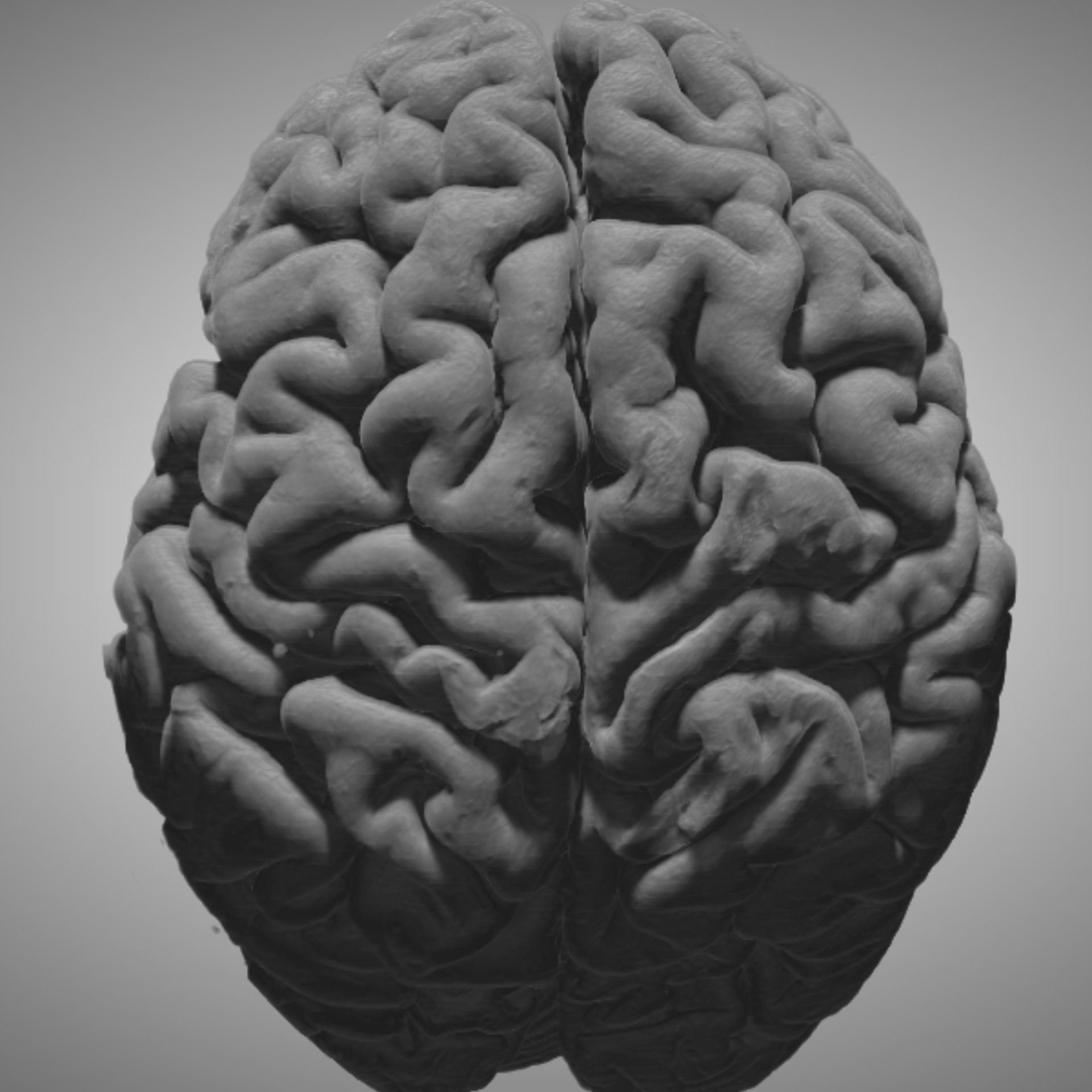 Anatomical Imaging | Neuroimaging - The University of Iowa