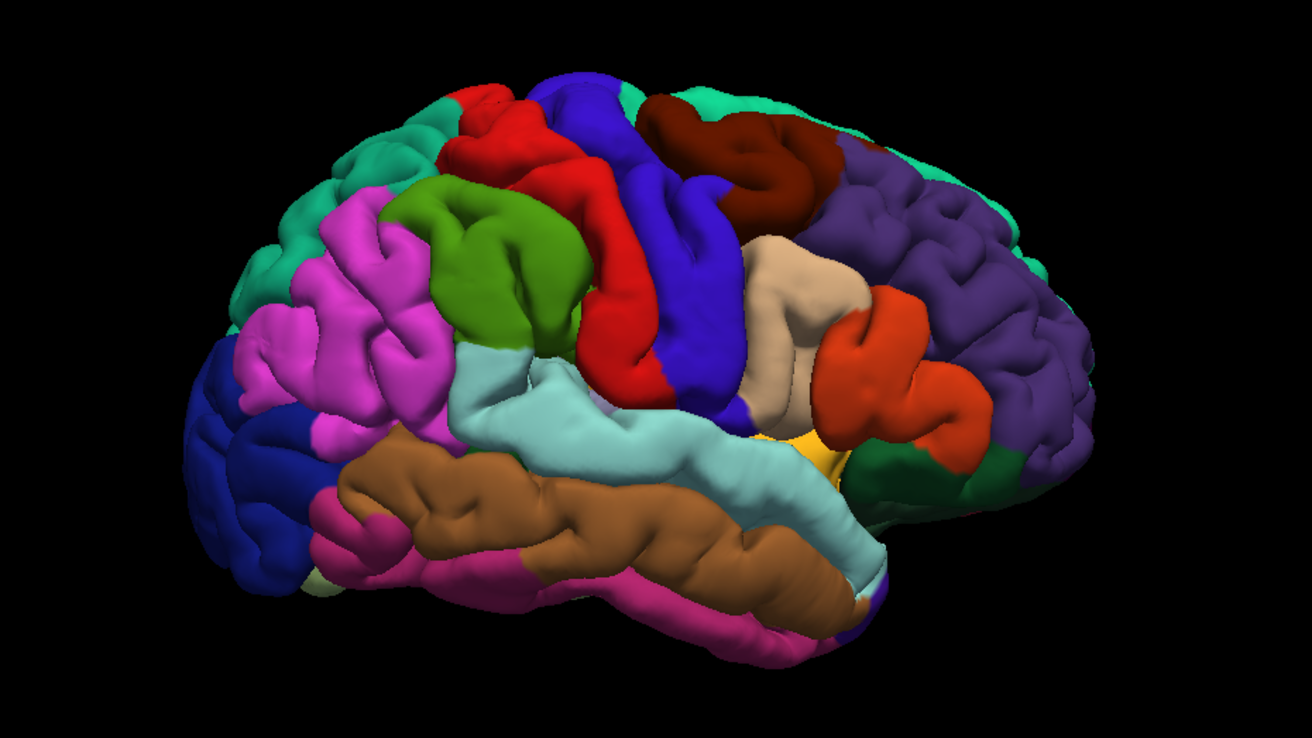 Anatomical Imaging | Neuroimaging - The University of Iowa