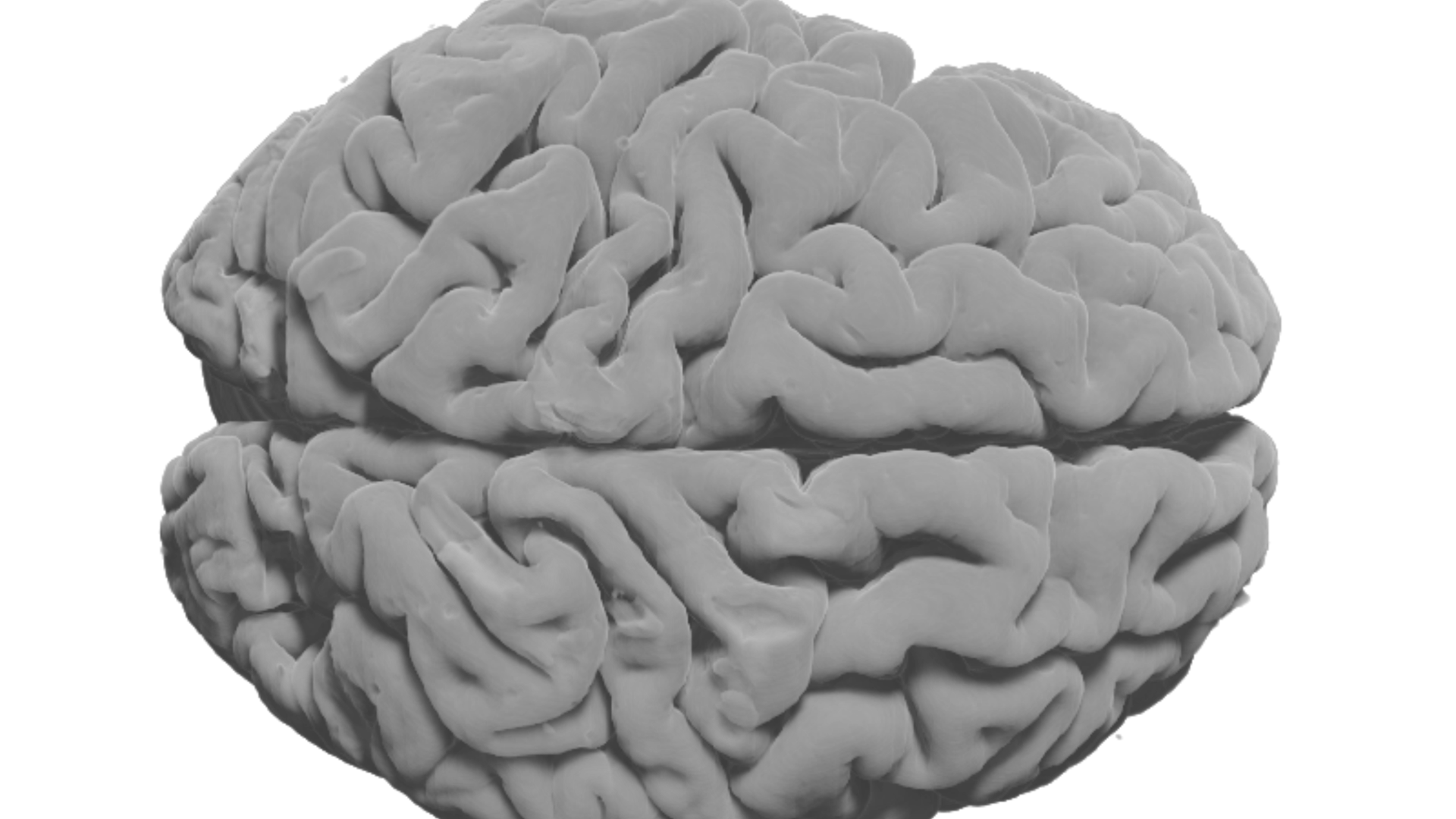 Diffusion Imaging | Neuroimaging - The University of Iowa