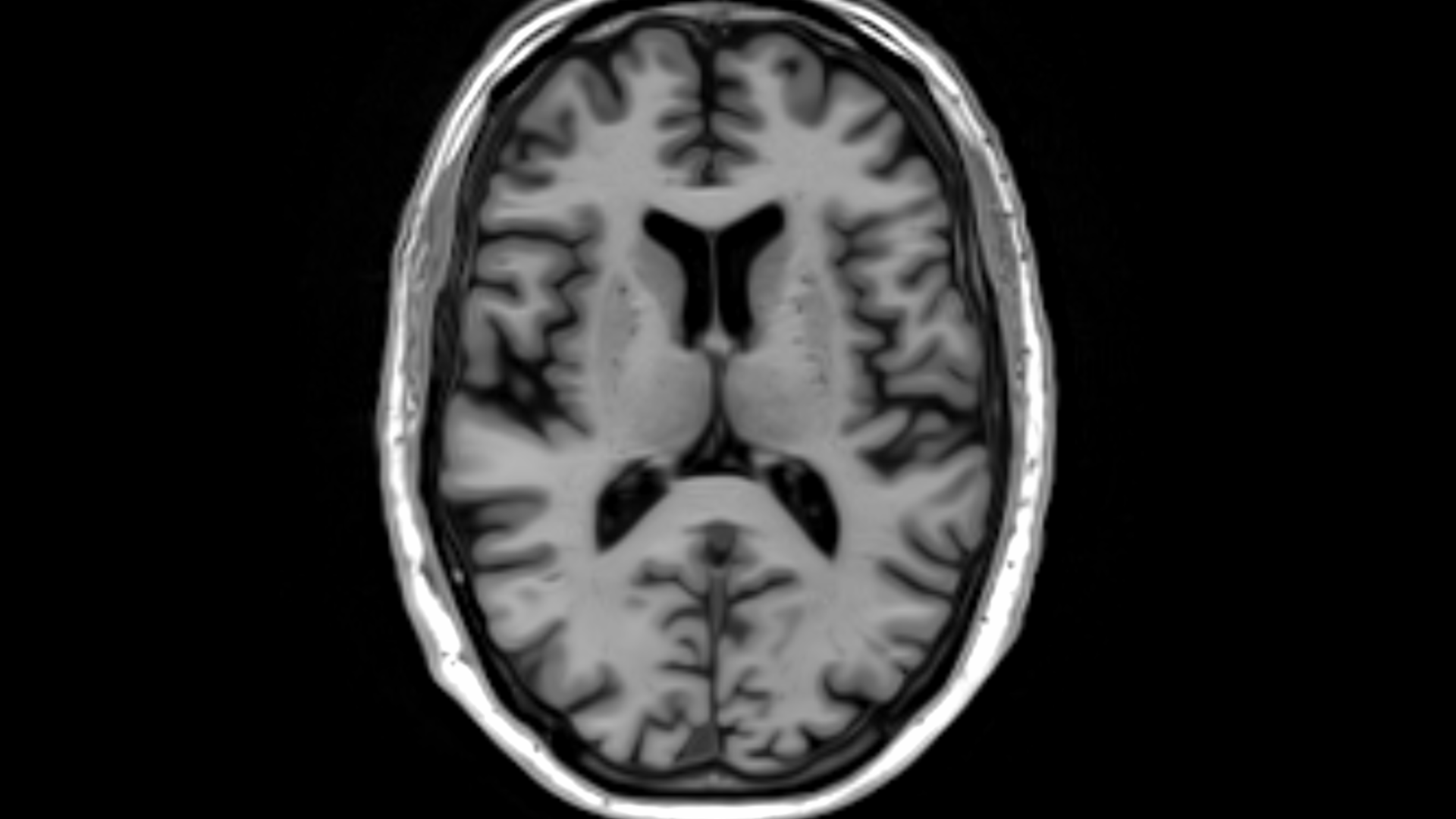 Anatomical Imaging | Neuroimaging - The University of Iowa
