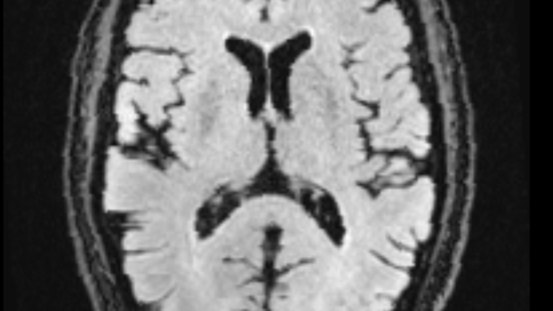 Anatomical Imaging | Neuroimaging - The University of Iowa