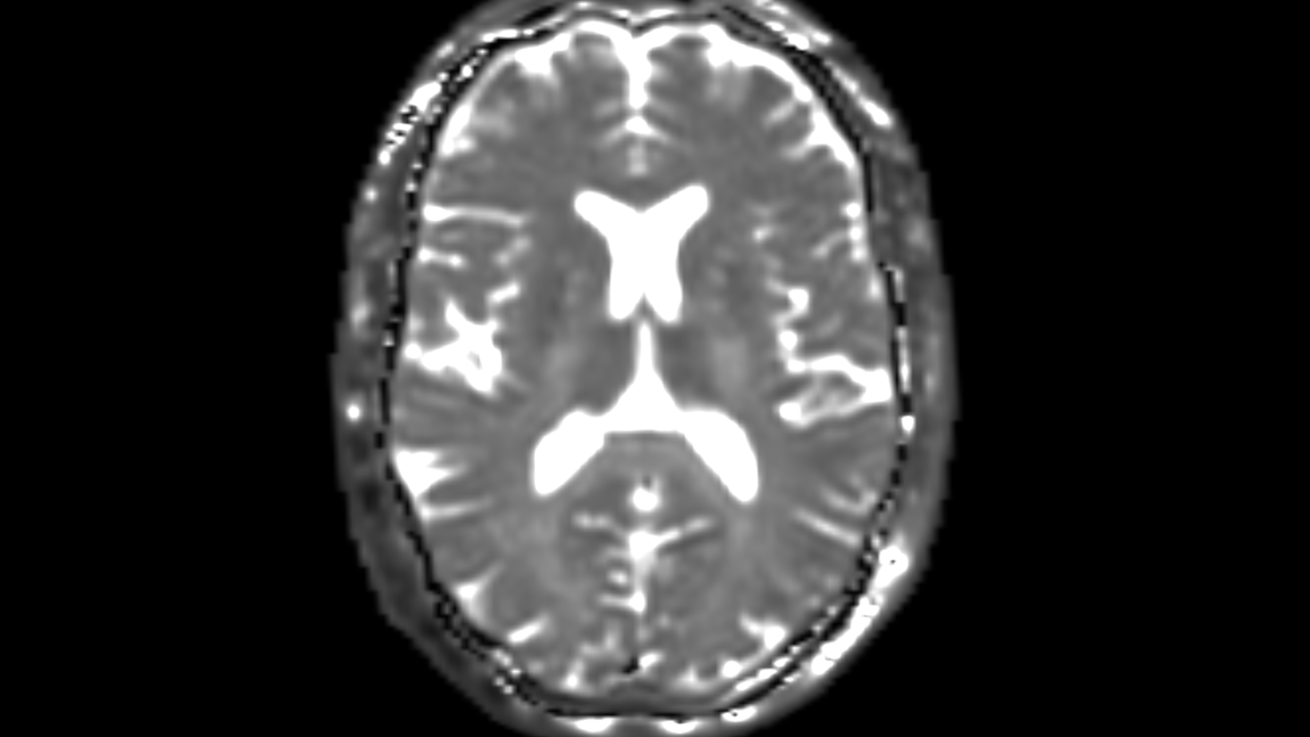 Anatomical Imaging | Neuroimaging - The University of Iowa
